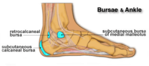 Joint Inflammation Problems Treatment | Boston Foot Ankle Biologics
