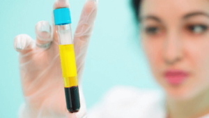 Platelet Rich Plasma Injections | Boston Foot Ankle Biologics