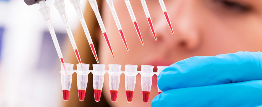 Ligament Laxity Treatment | Boston Foot Ankle Biologics