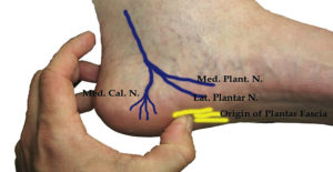 Baxter’s Nerve Entrapment Treatment | Boston Foot Ankle Biologics